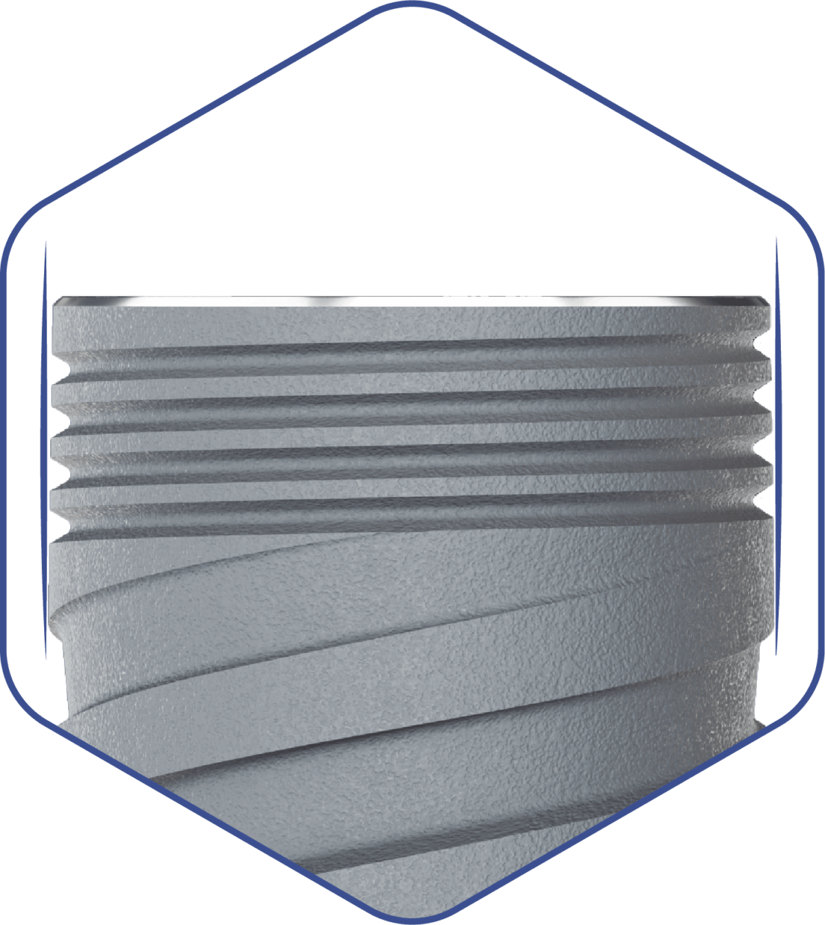 SMART® - Notch Implant