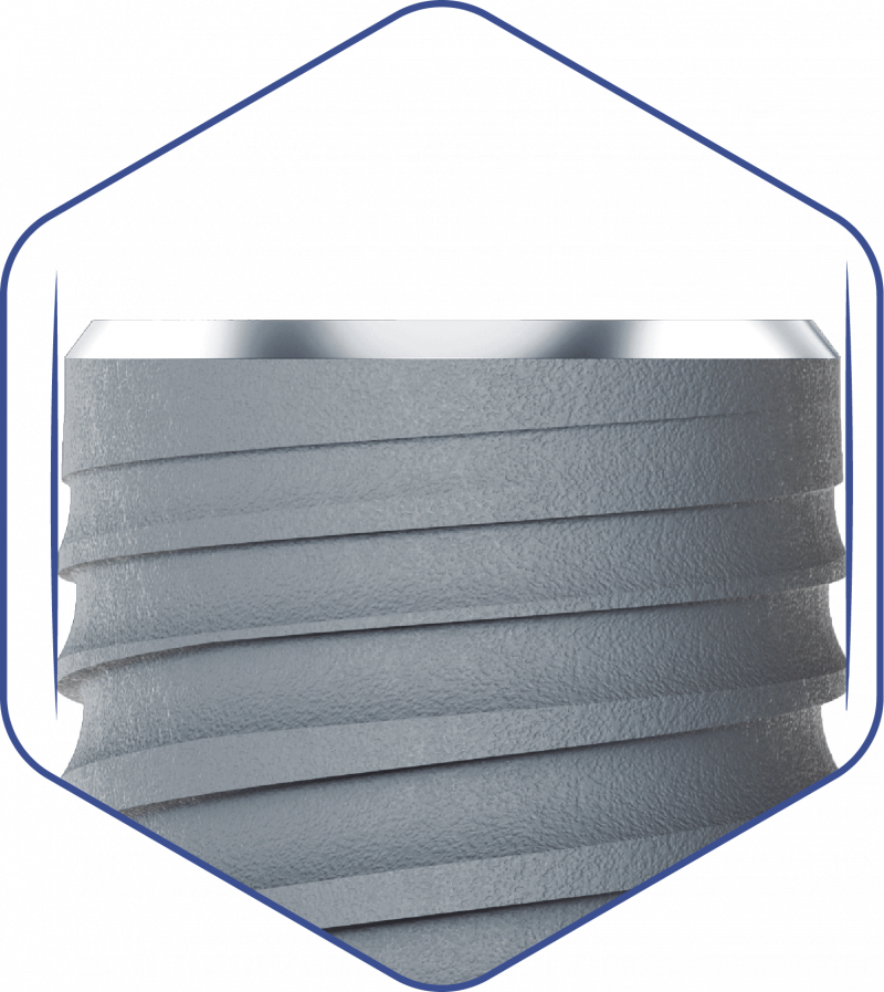 UNIQUE® - Notch Implant